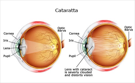 CATARATTA - Romolo Appolloni